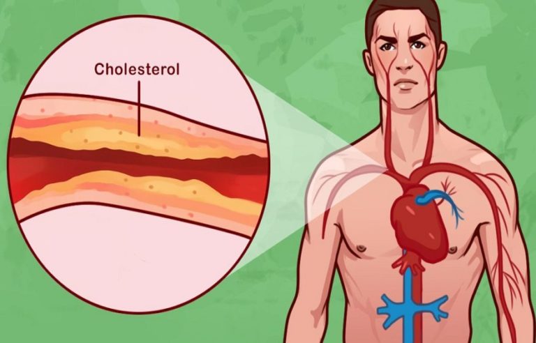 Cholesterol In The Human Body – Health Blog